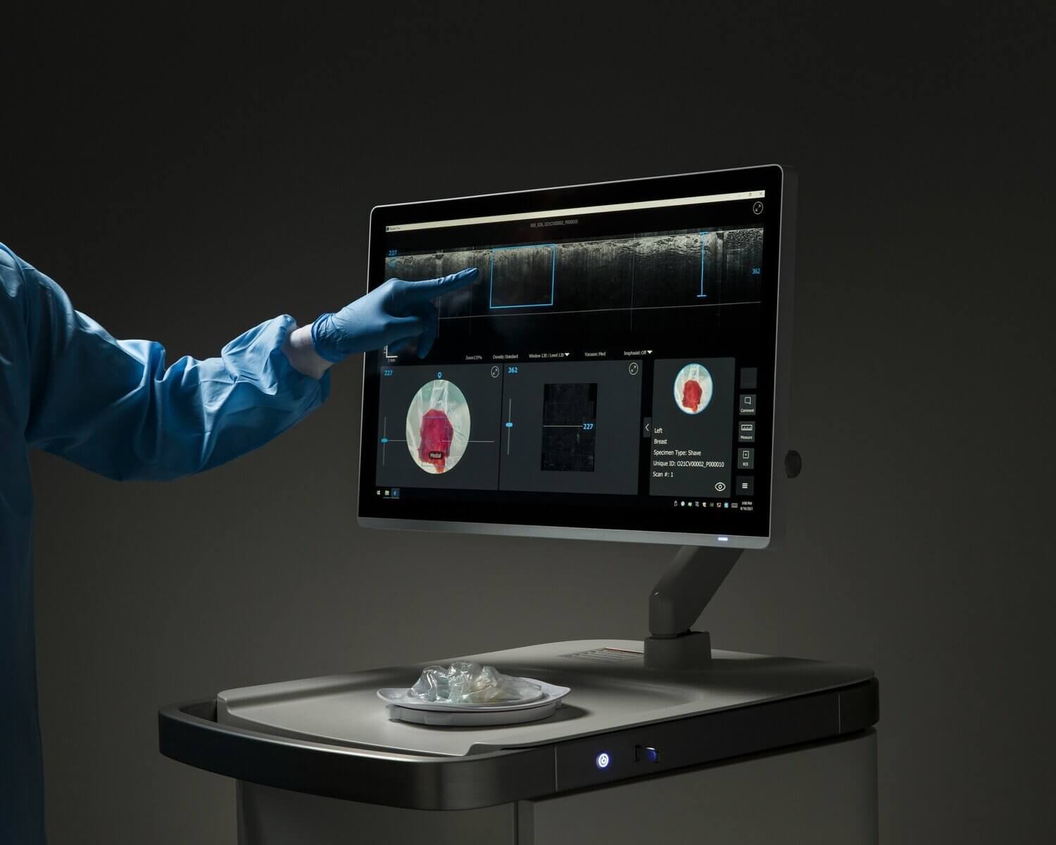 Bayer, Perimeter Medical Imaging AI, Siemens Healthineers - Diagnostics ...